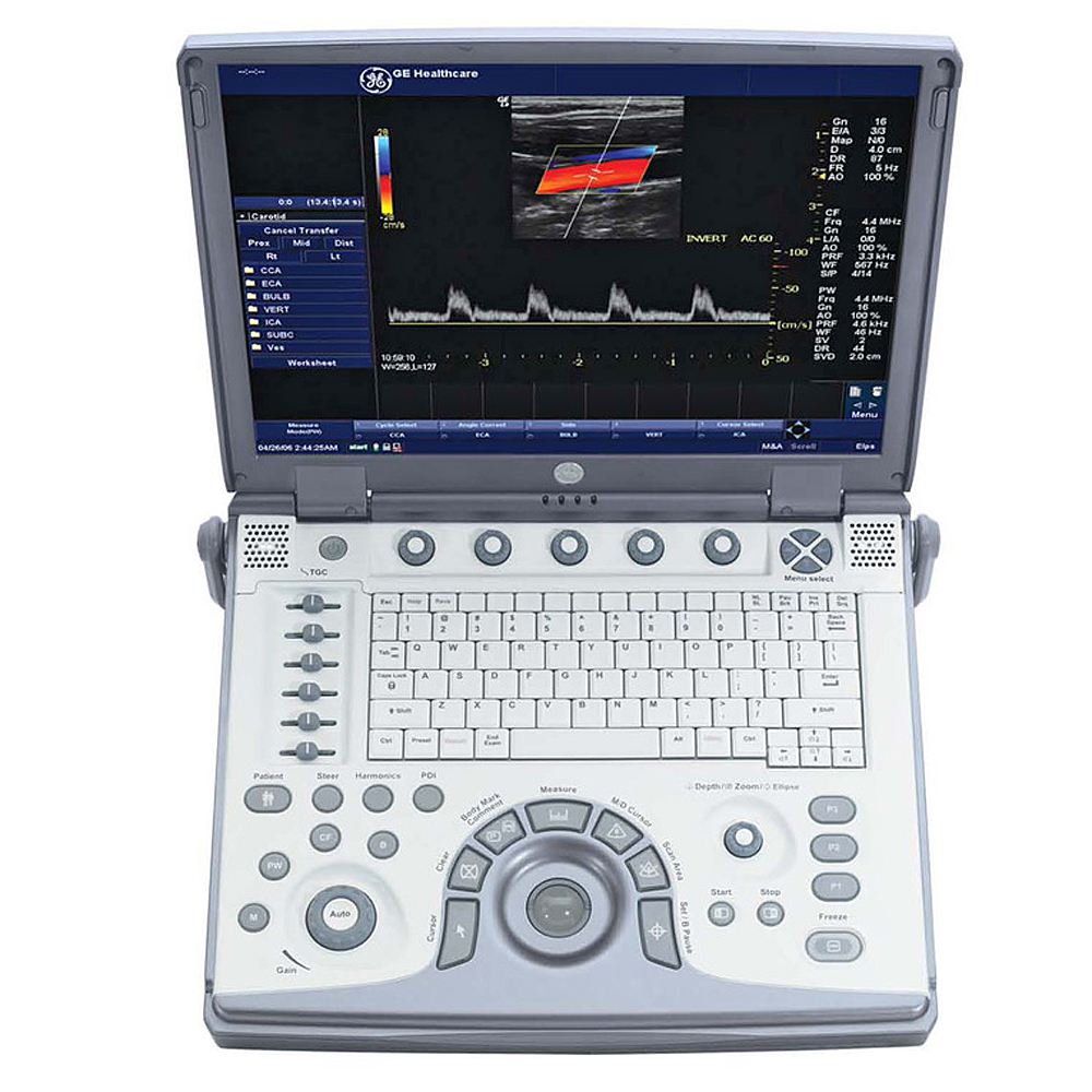 Ультразвуковая система LOGIQ E - DM-Group